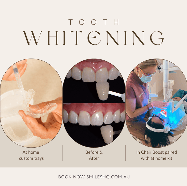 Patient Specials | SmilesHQ Warners Bay